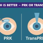 PRK vs. TransPRK: Which is Better? | Centre For Sight