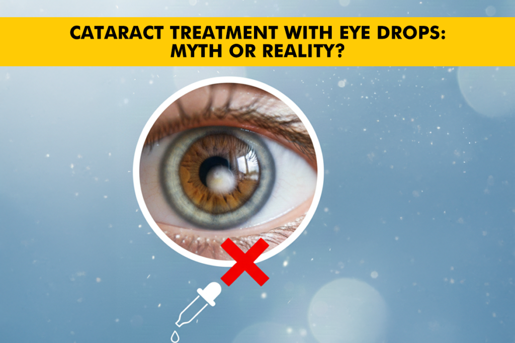 Can Cataracts Be Treated With Eye Drops? Myths vs Facts