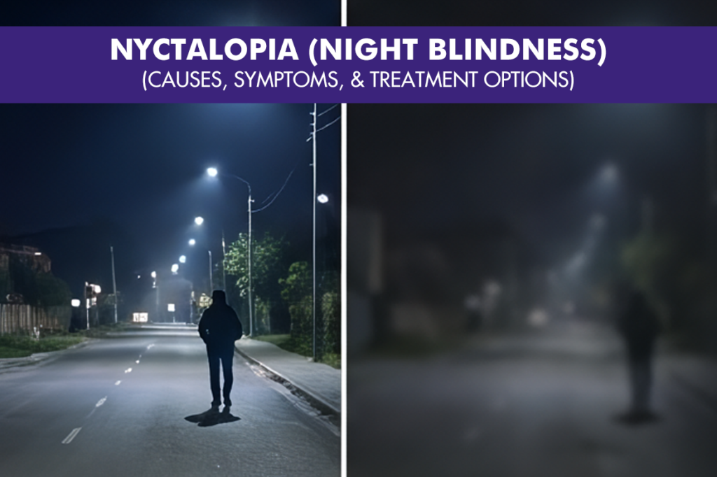 Night Blindness (Nyctalopia): Causes, Diagnosis & Treatment
